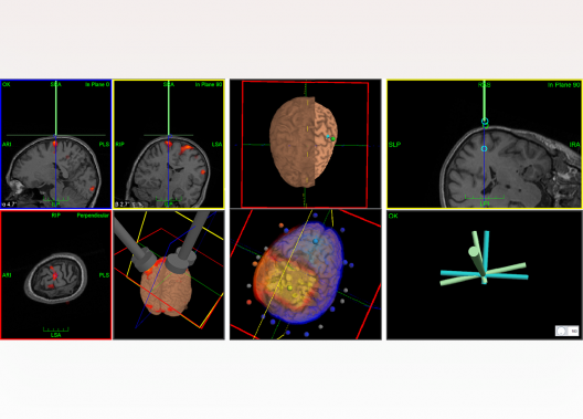 TMS Navigator Localite Classic Edition | Neurolite Advanced Medical Solutions
